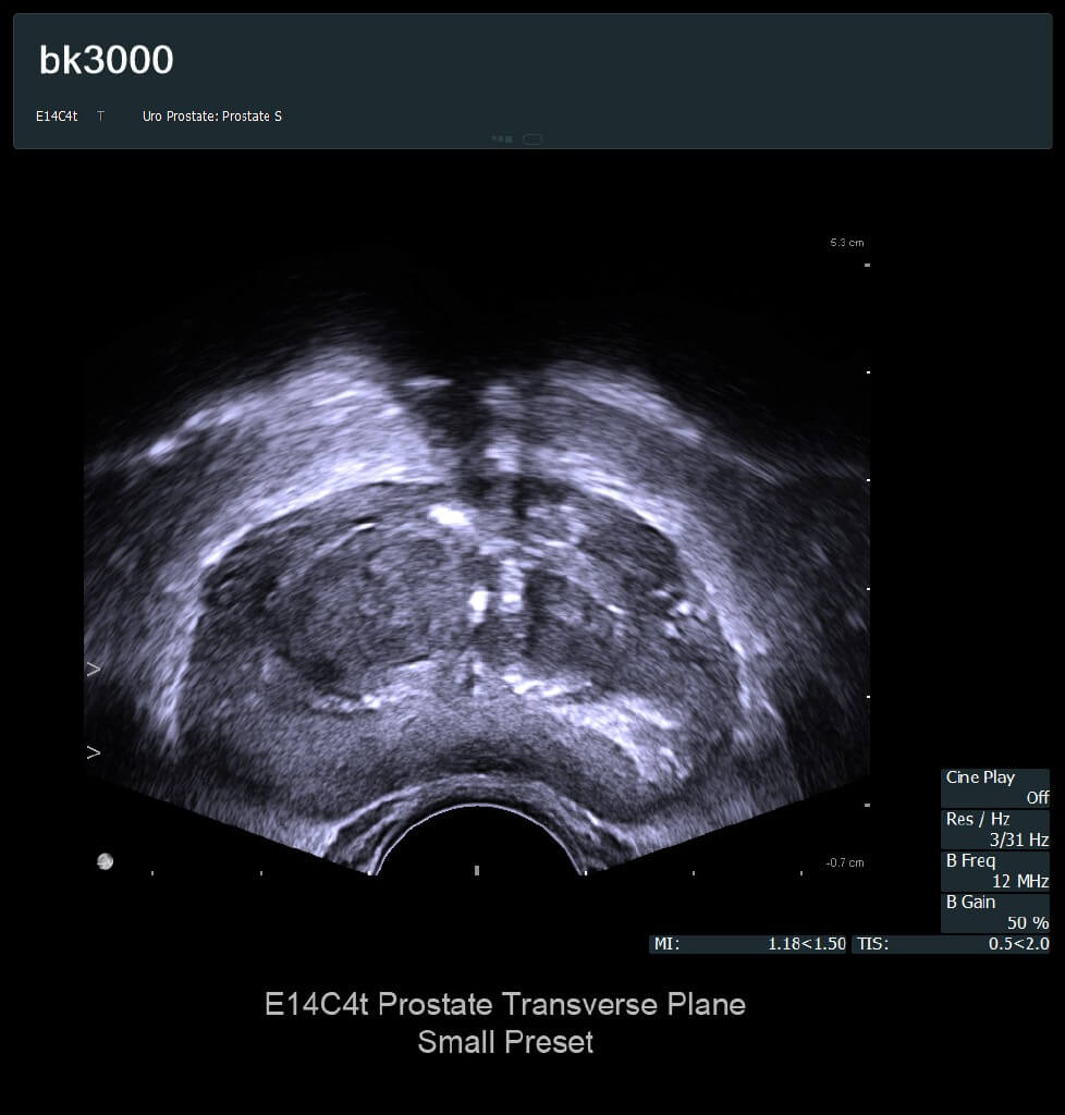 bk3000 | ProMedical Oy