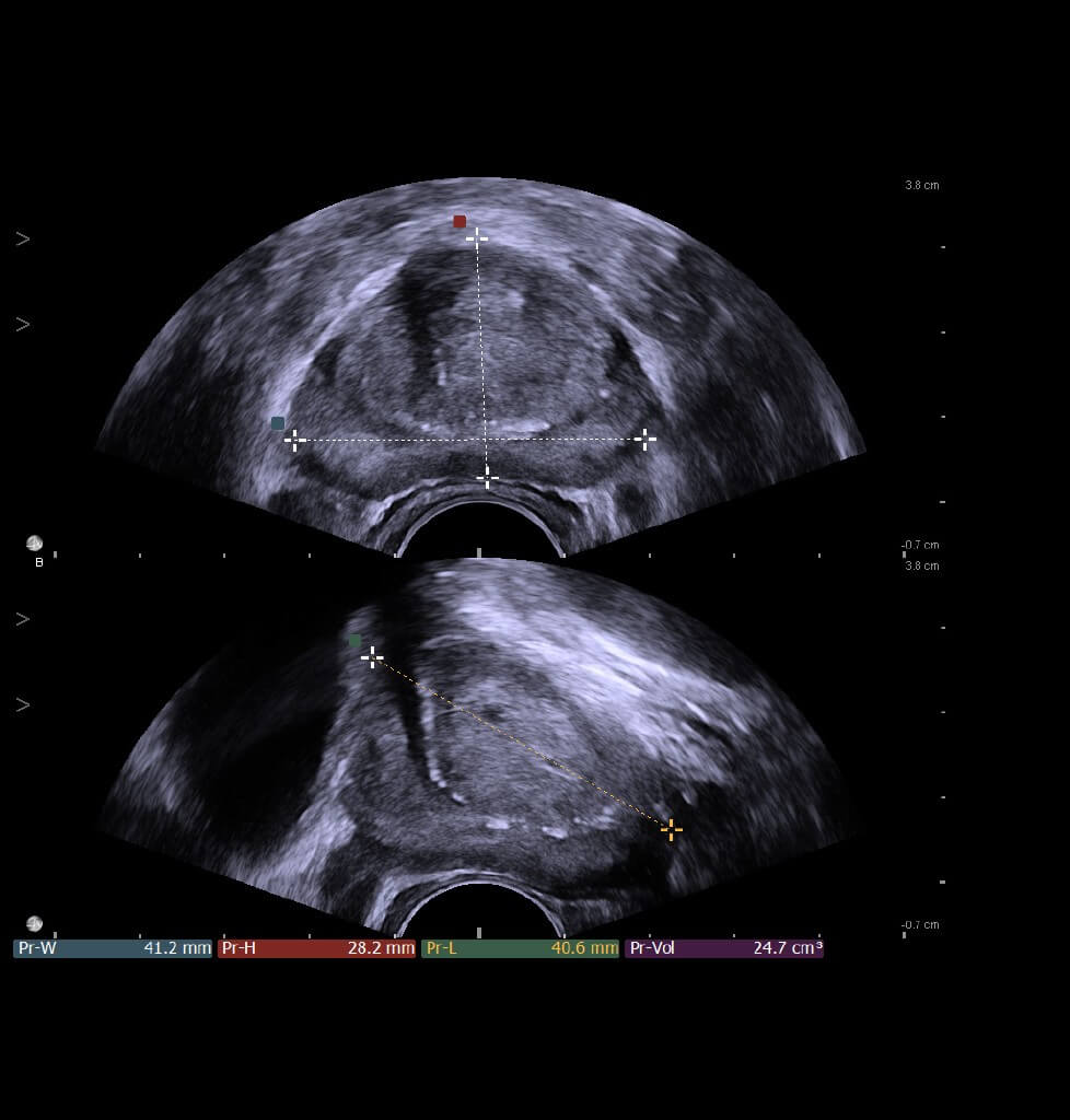 bk3000 | ProMedical Oy