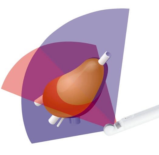 bk3000 | ProMedical Oy