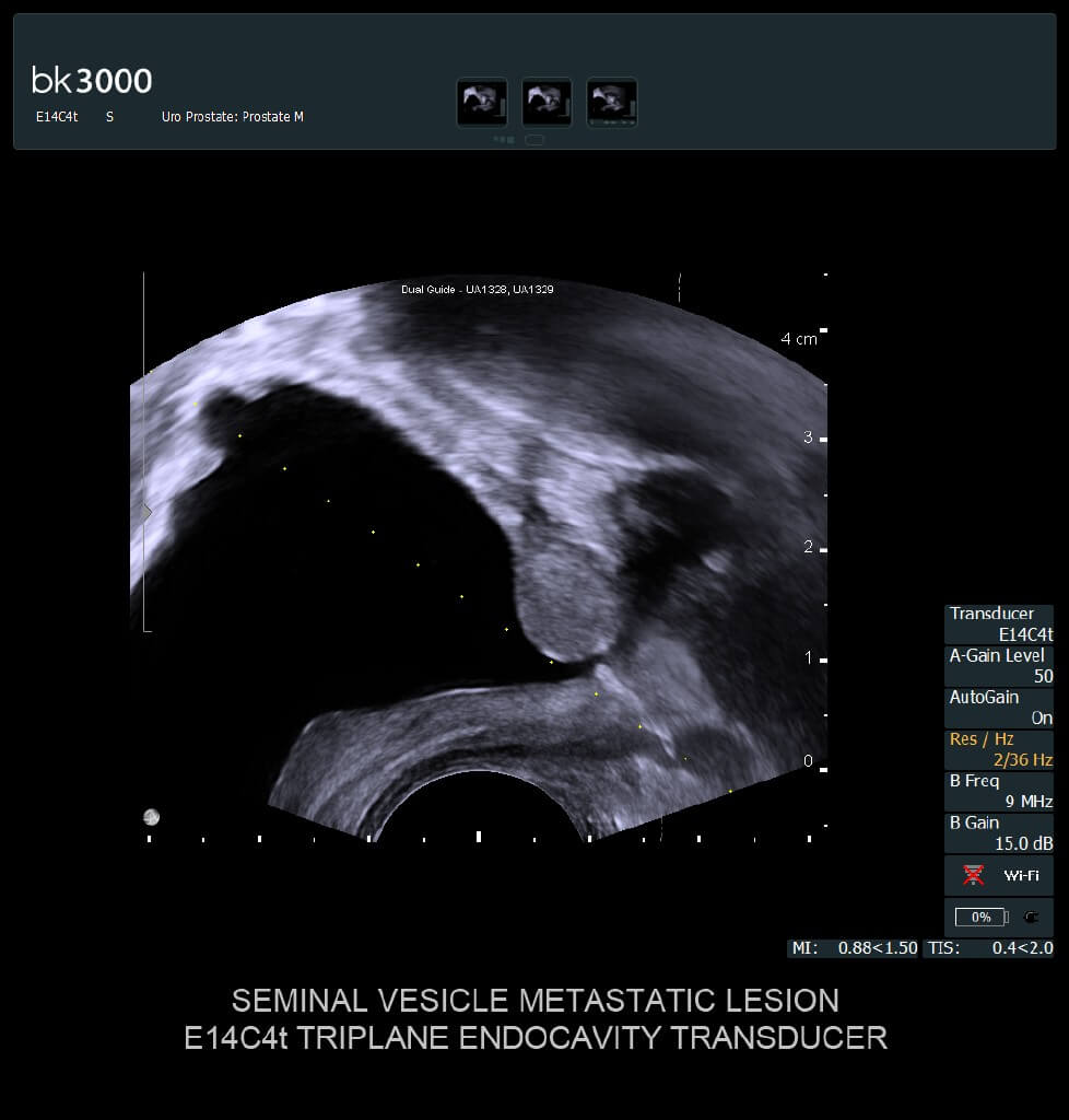 bk3000 | ProMedical Oy