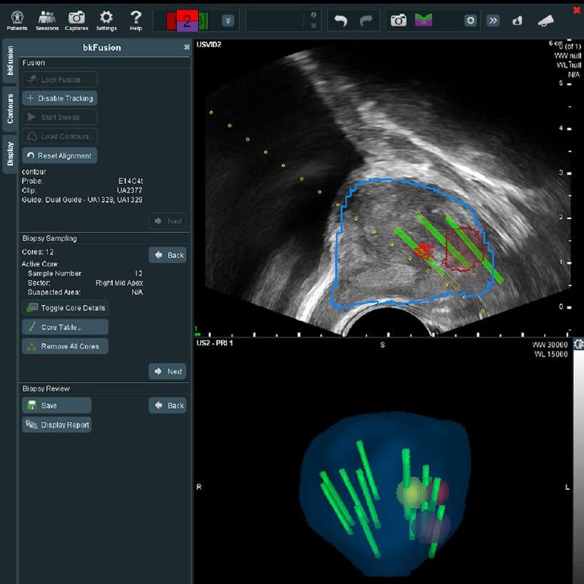 bk3000 | ProMedical Oy
