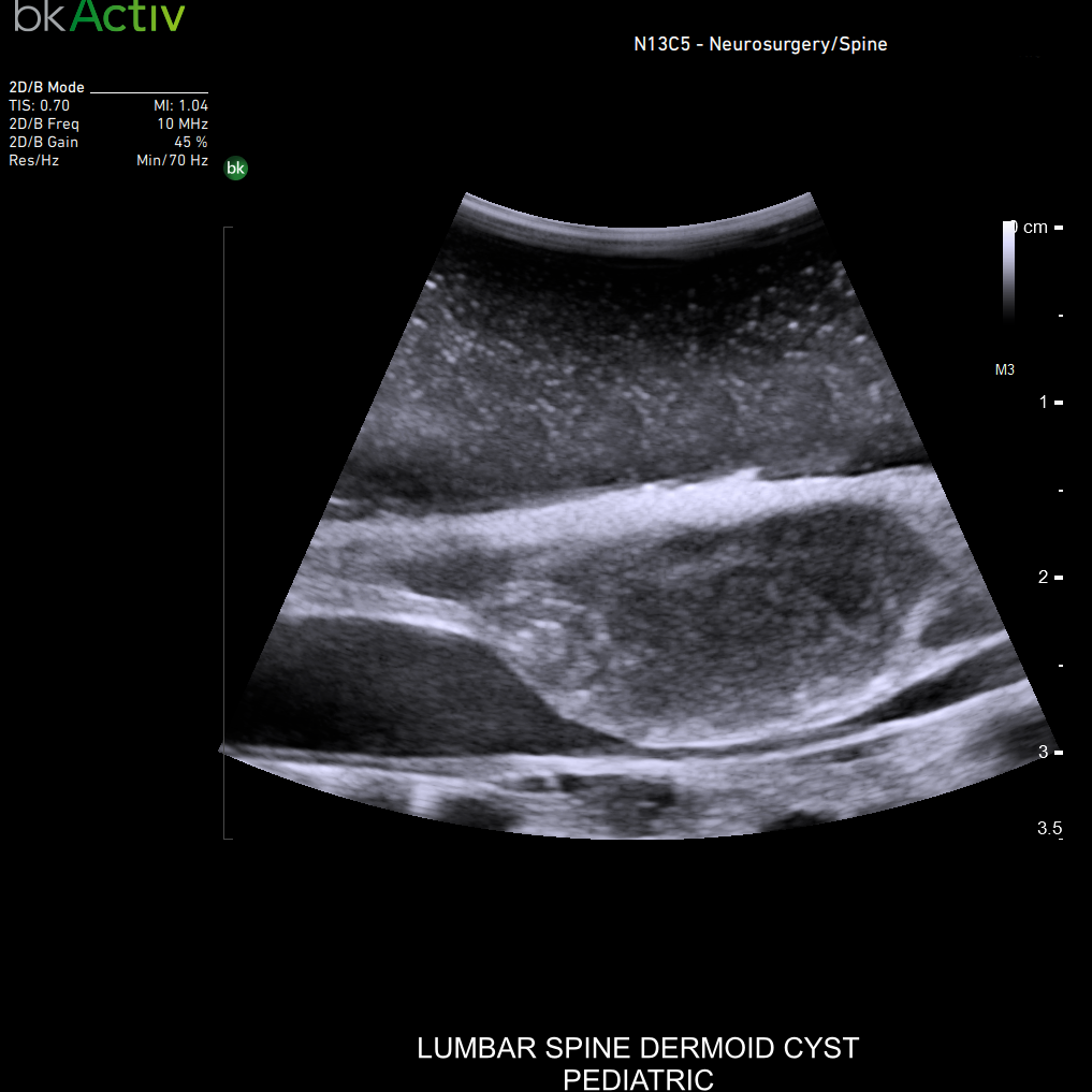 bkActiv | ProMedical Oy