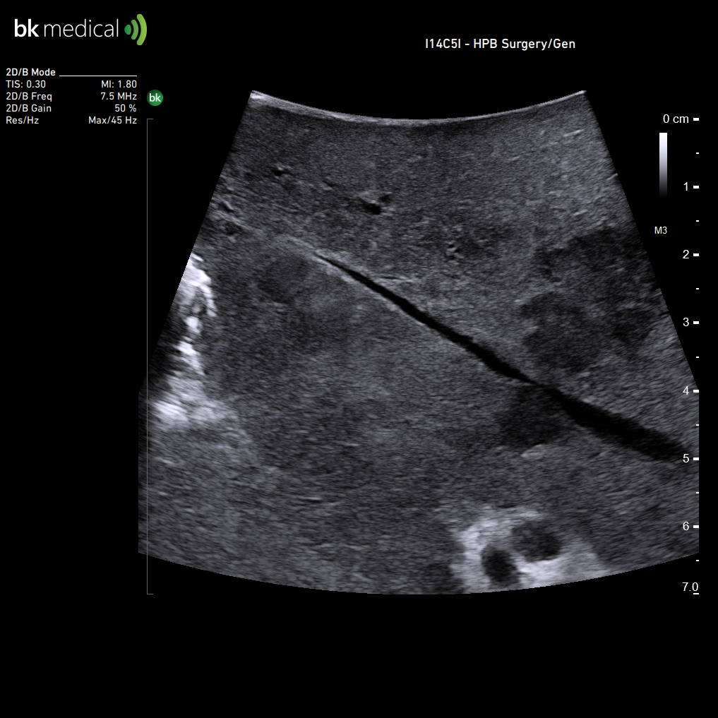 bkActiv | ProMedical Oy